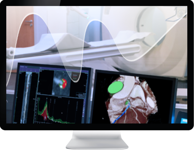 Medis Medical Imaging - Imaging Solutions in a Heartbeat