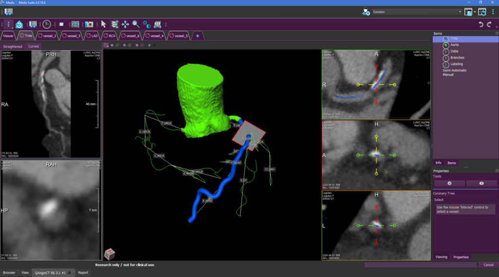 2image1_large - medisimaging