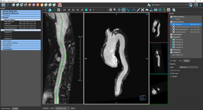 3DView-CPR - medisimaging