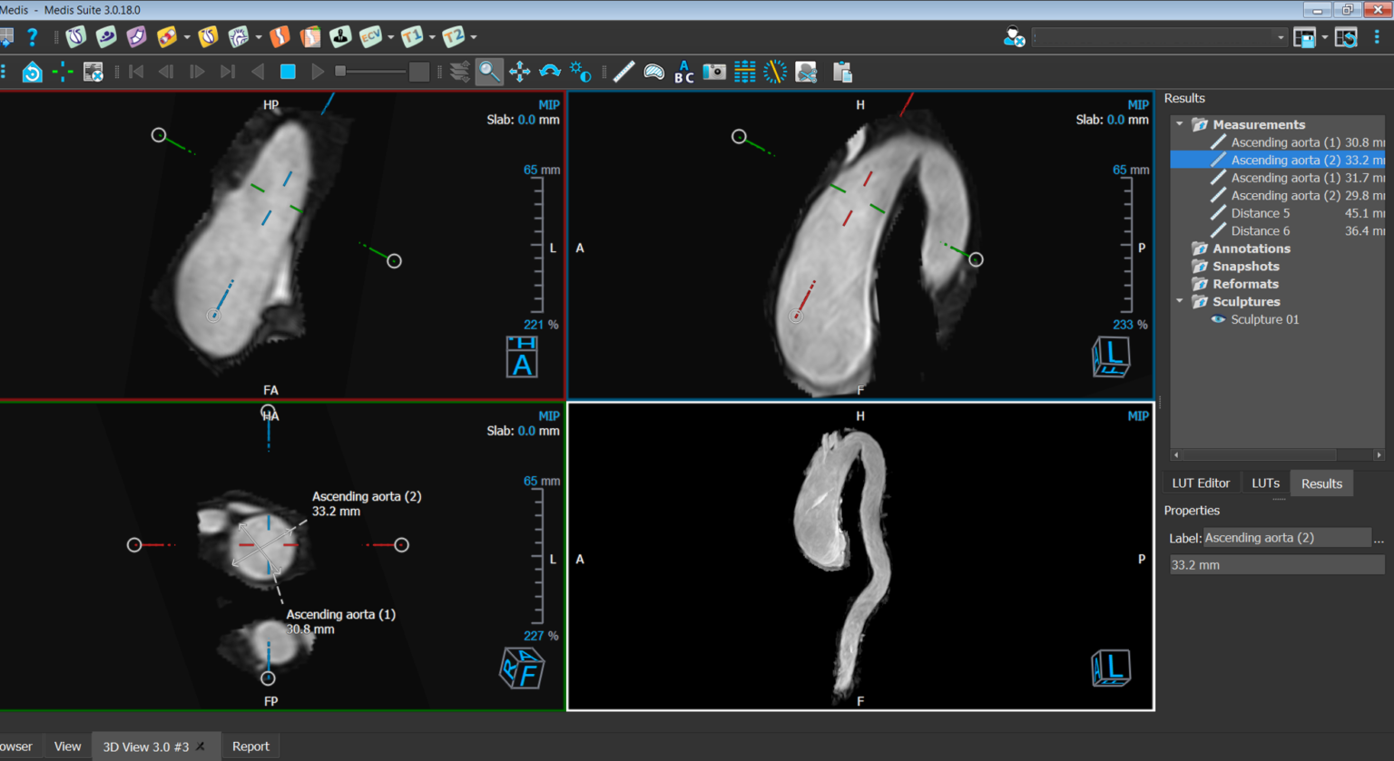 3DView_MRA2 - medisimaging