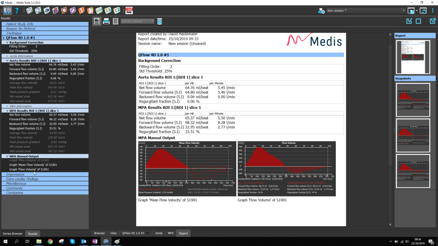 4d-flow-report - medisimaging
