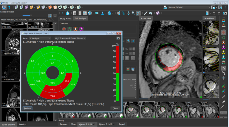 Tissue Characterization - Medis Suite MR