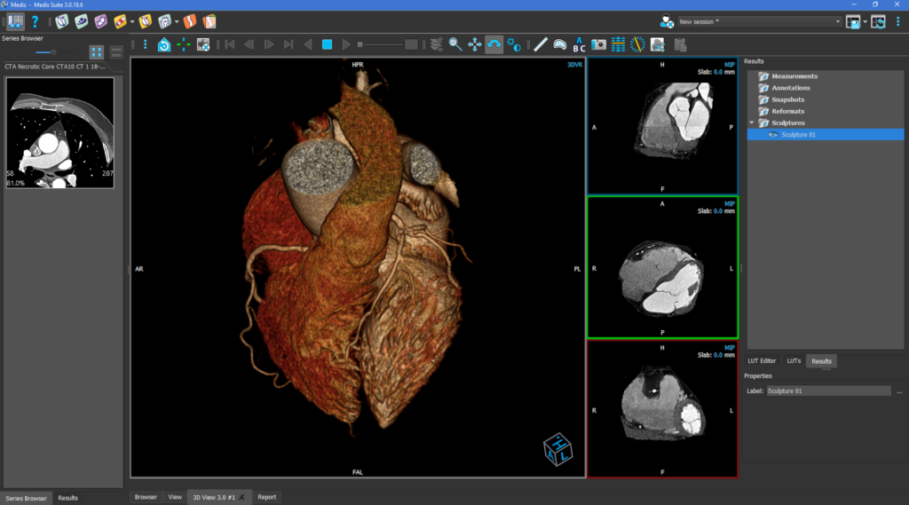 IImage1_large-2 - medisimaging
