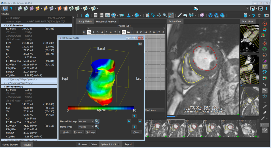 LVRVFunction_2 - medisimaging