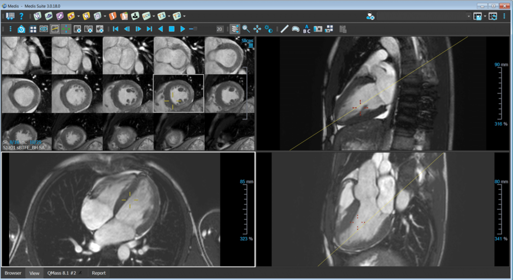 View_Multiple_Cines - medisimaging
