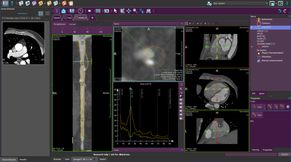 image2_large-2 - medisimaging