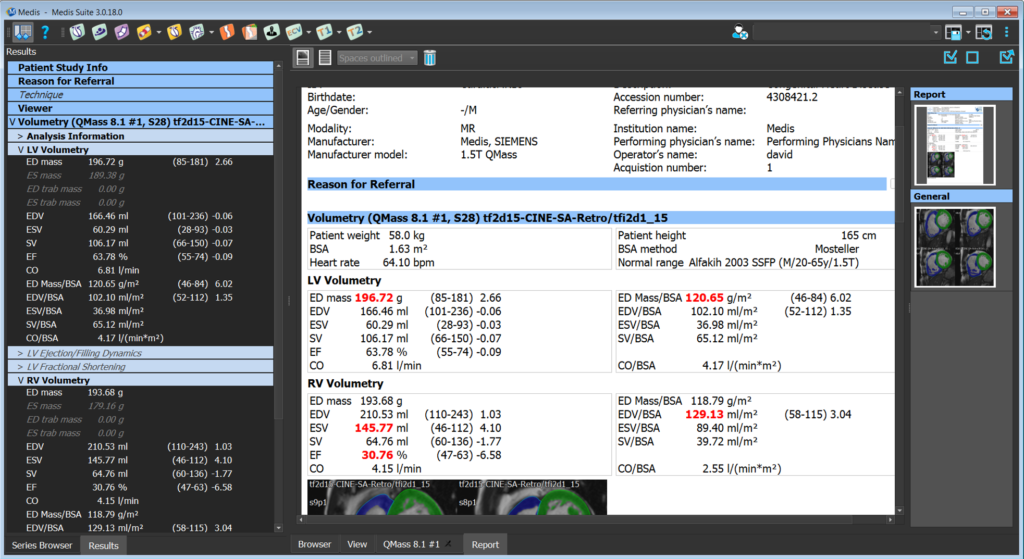 report_LVRV - medisimaging