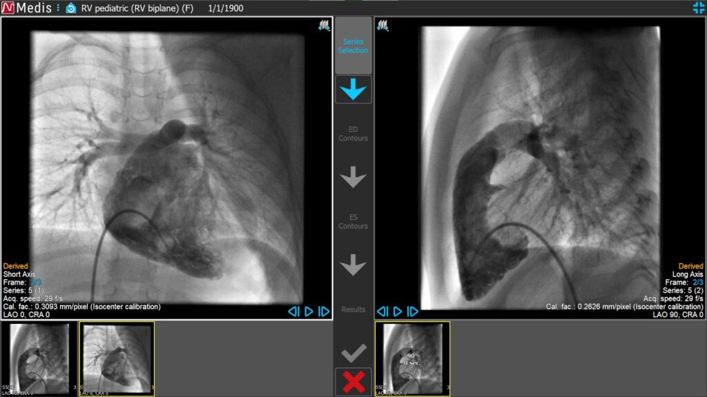 1 Series Selection QRV Biplane - medisimaging