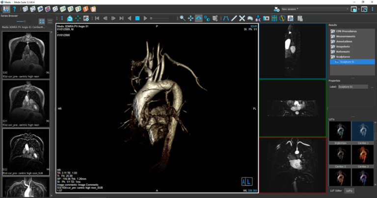 medisimaging - Medis Suite Solutions - MR - 3D Viewer
