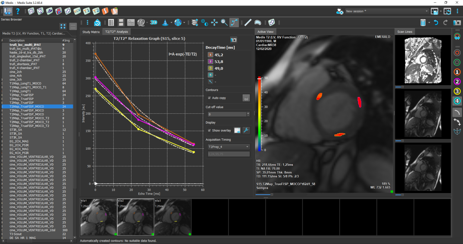 t2-t2-mapping - medisimaging