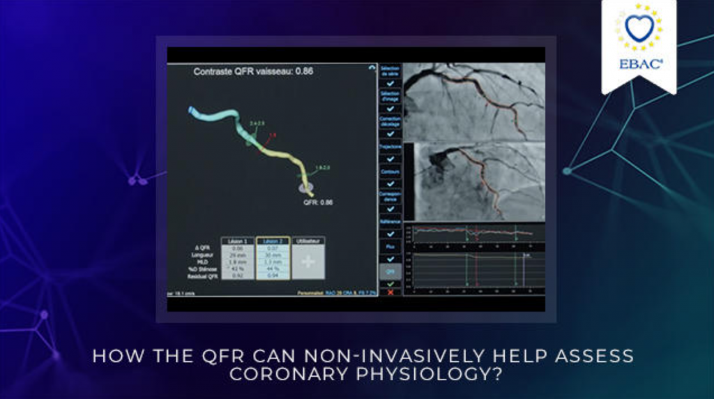 QFR in cathlab - medisimaging