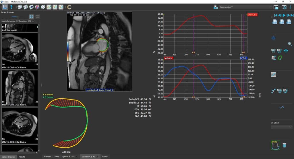 AtriaCarousel1 - medisimaging