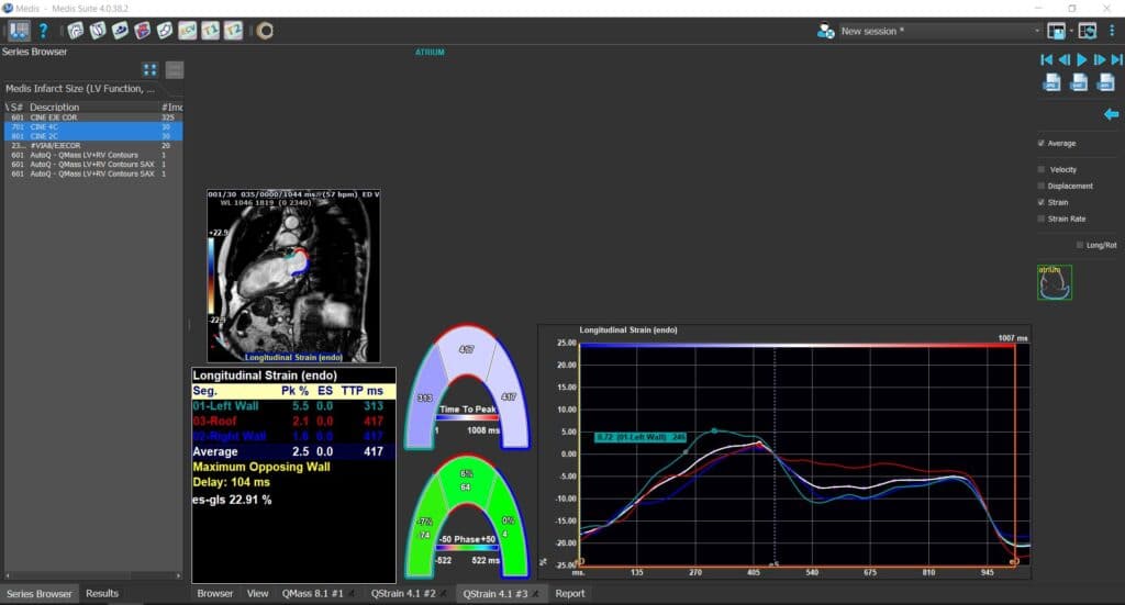 AtriaCarousel2 - medisimaging