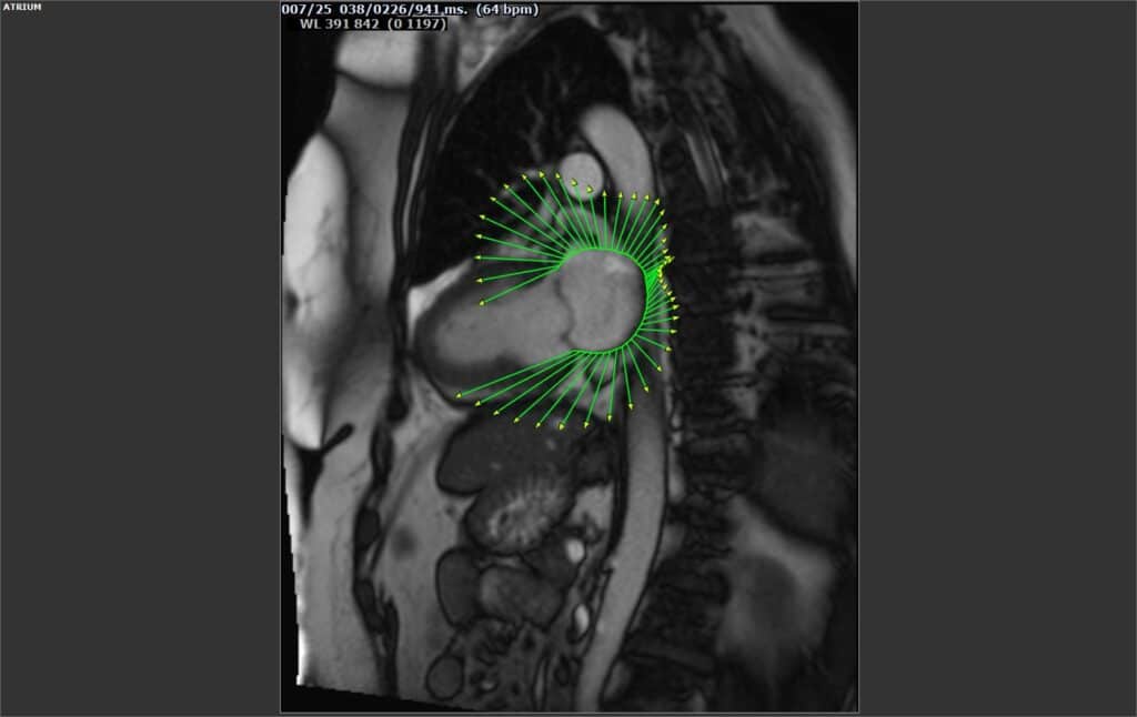 AtriaCarousel3 - medisimaging