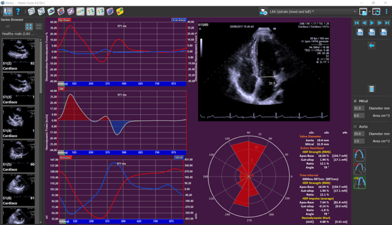 Hemodynamic Forces Medisimaging