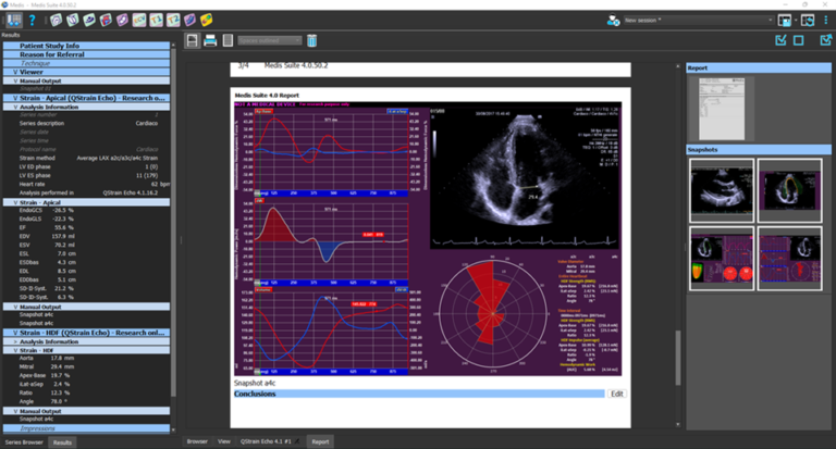 medis-ultrasound-report - medisimaging