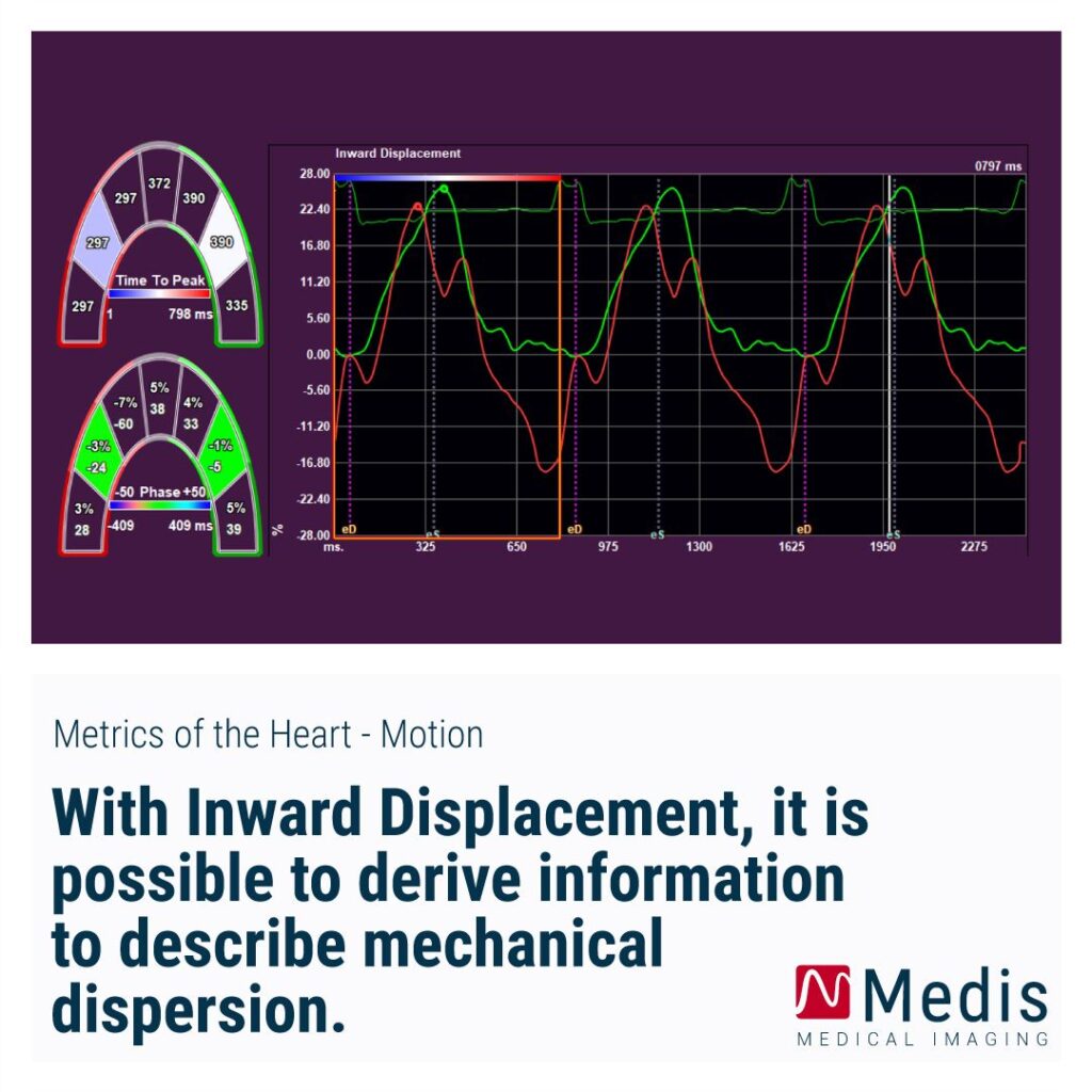 inward-displacement-derive-info - medisimaging
