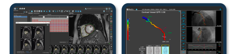 Cardiac Imaging Software - Medis Medical Imaging