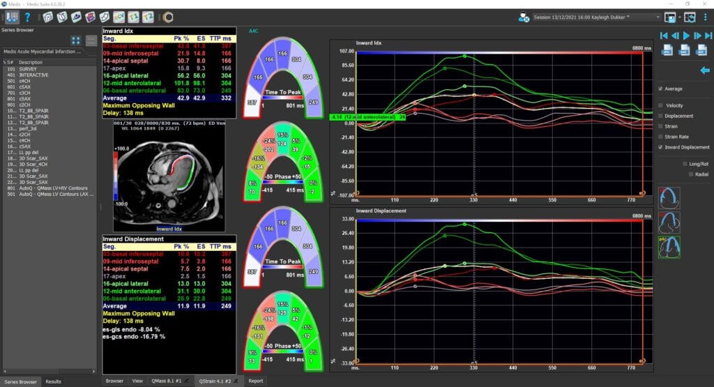 INWcarousel1-1024x555 - medisimaging