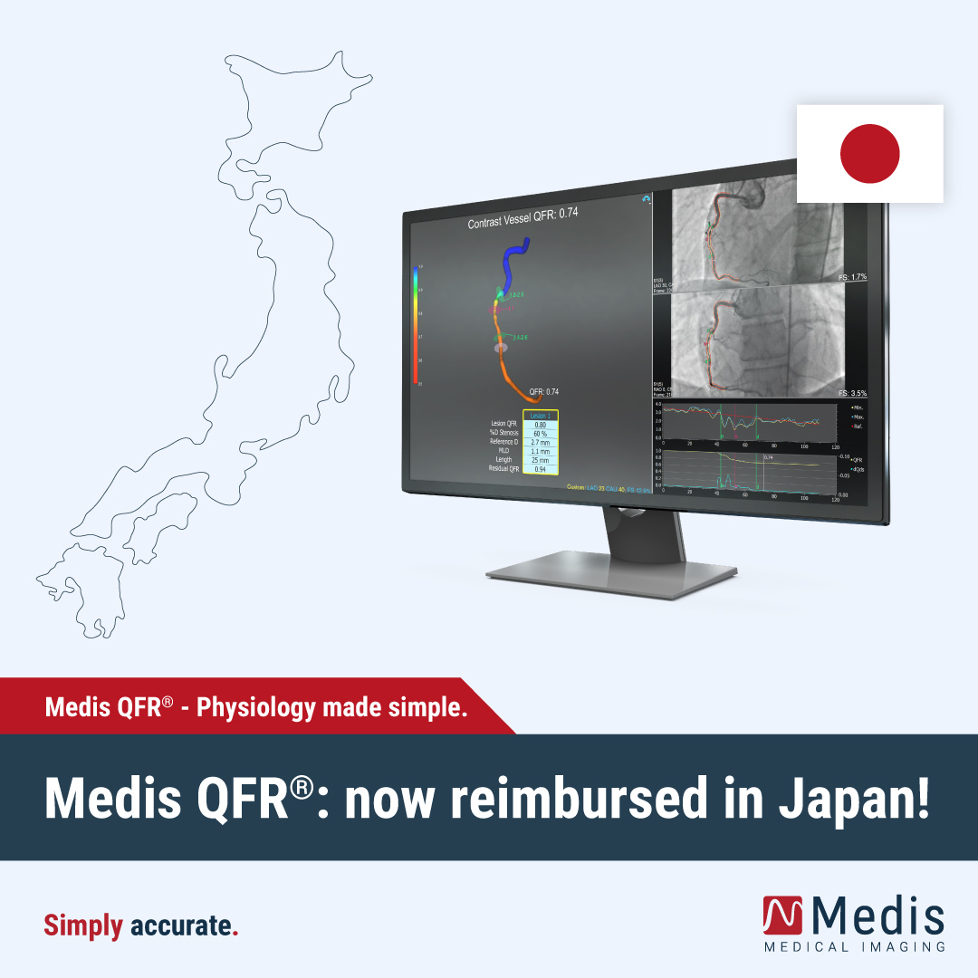 medisimaging - Medis Suite Solutions - Medis QFR®