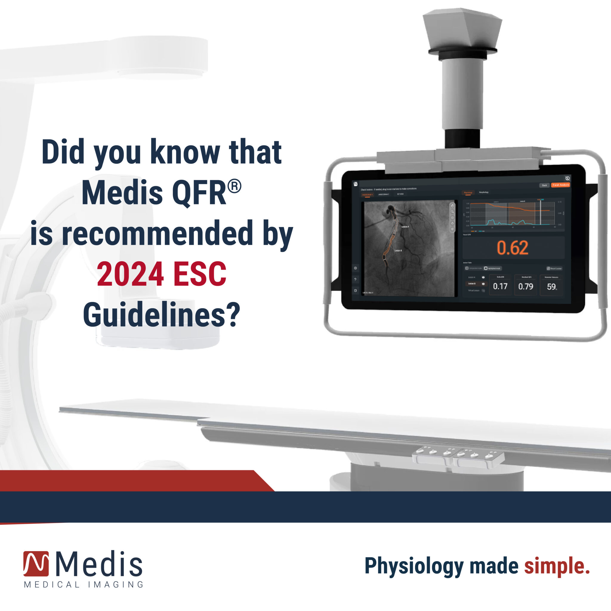 Cardiac Imaging Software - Medis Medical Imaging